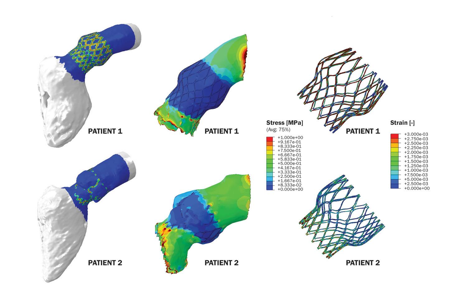 In Silico Hybrid Trials | Thornton Tomasetti